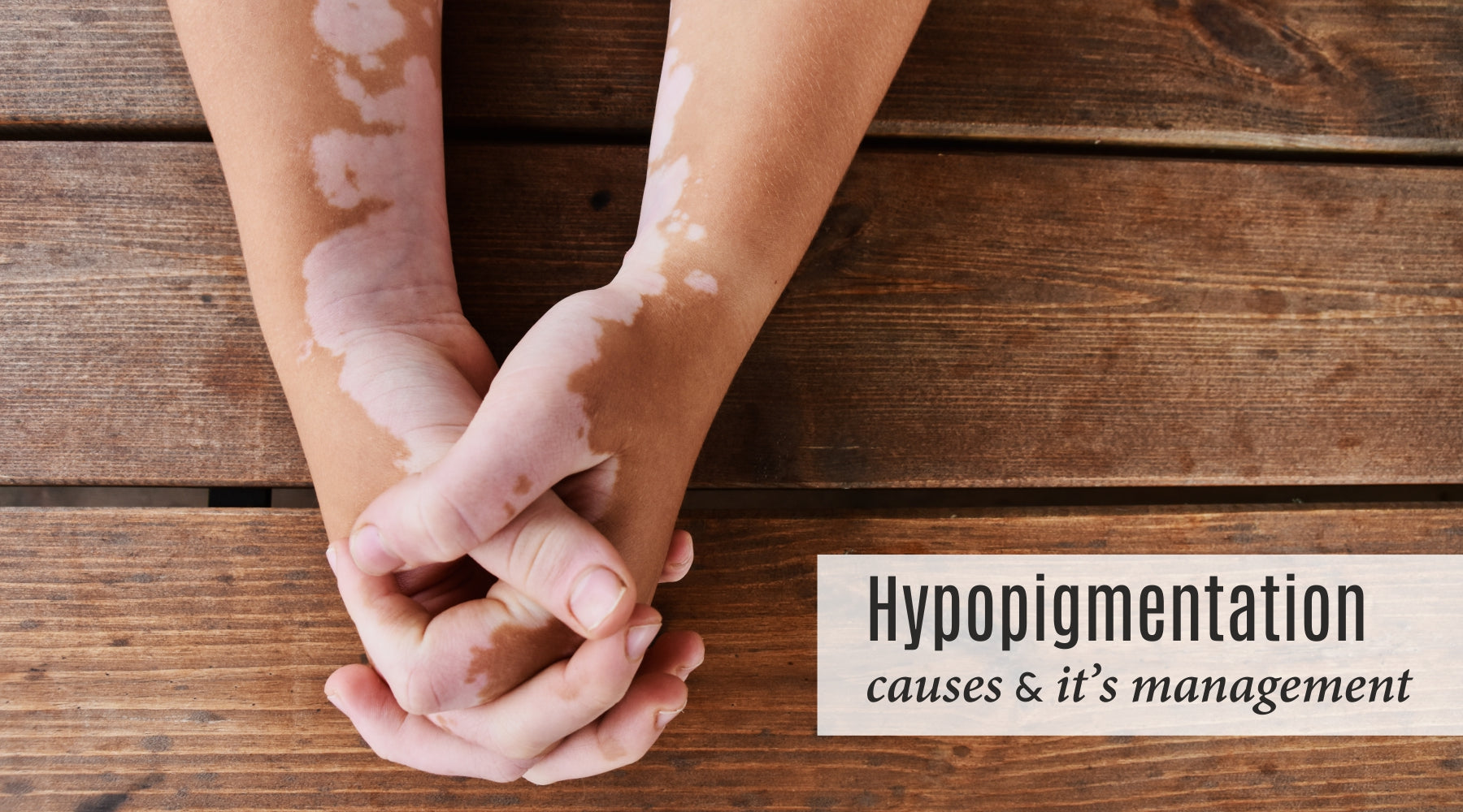 Hypopigmentation | what its causes, symptoms and management ...